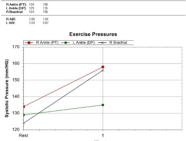 Exercise After Pulmonary Embolism: Is it safe? How is it done?